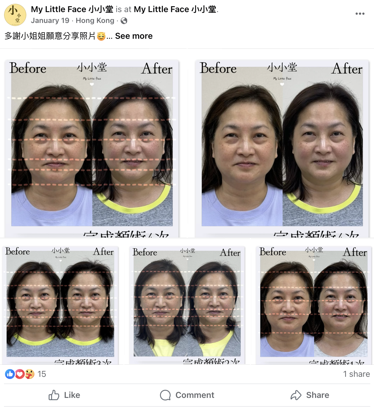 小小堂 MY LITTLE FACE – 小小堂 MY LITTLE FACE